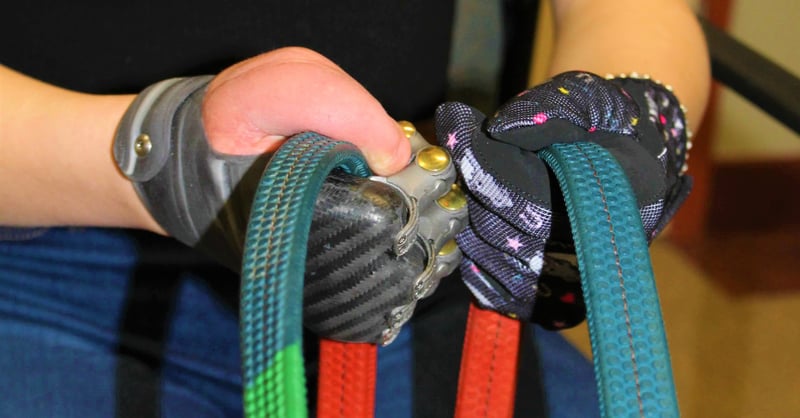 Point Designs Prosthetic Fingers: Point Digit, Point Partial, and Point ...