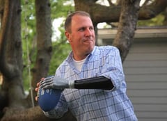 Meet The Team That Produces Our Heavy-Duty Prosthetic Fingers